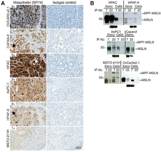 Preclinical Efficacy of an Antibody–Drug Conjugate Targeting Mesothelin ...