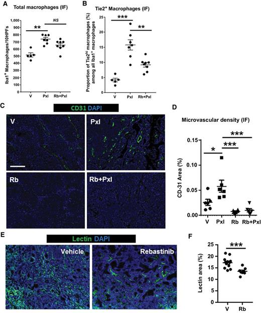 The Selective Tie2 Inhibitor Rebastinib Blocks Recruitment and Function ...