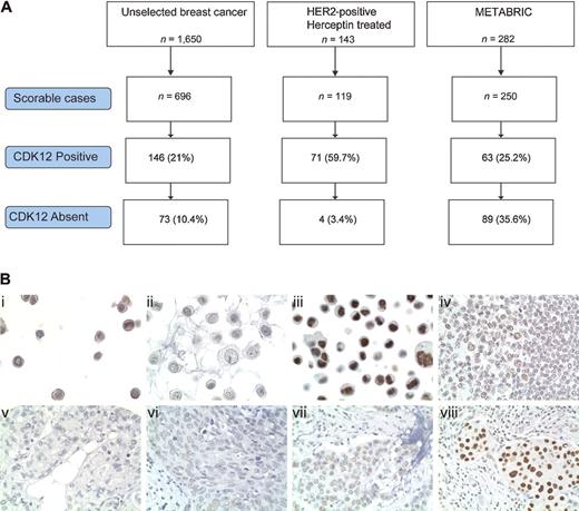 Evaluation of CDK12 Protein Expression as a Potential Novel Biomarker ...