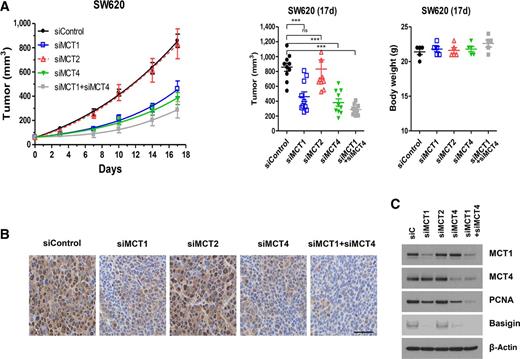 MCT4 Expression Is a Potential Therapeutic Target in Colorectal Cancer ...