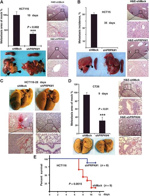 Targeting PRPK Function Blocks Colon Cancer Metastasis | Molecular ...
