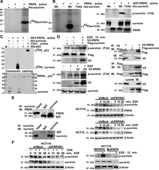 Targeting PRPK Function Blocks Colon Cancer Metastasis | Molecular ...
