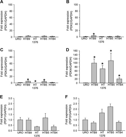The Role of Pyruvate Dehydrogenase Kinase-4 (PDK4) in Bladder Cancer ...