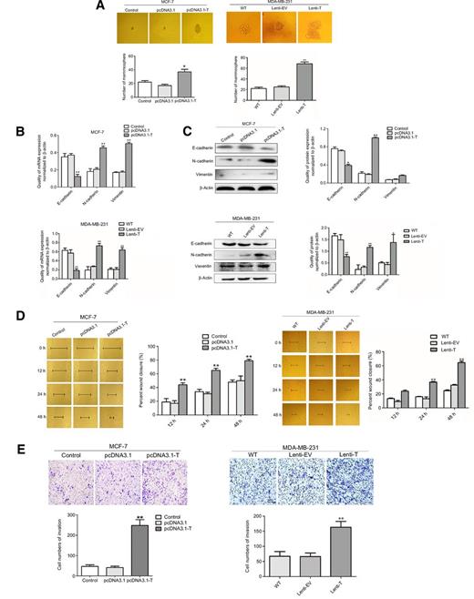Transgelin 2 Promotes Paclitaxel Resistance, Migration, and Invasion of ...