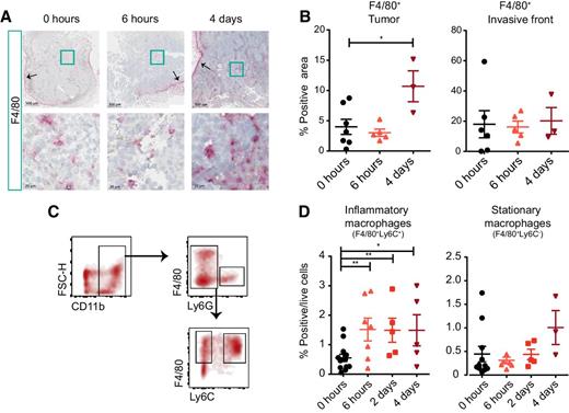 CD3-Bispecific Antibody Therapy Turns Solid Tumors into Inflammatory ...