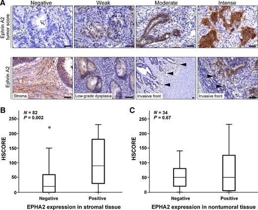 EPHA2 Is a Predictive Biomarker of Resistance and a Potential ...