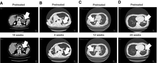 TAS-121, A Selective Mutant EGFR Inhibitor, Shows Activity Against ...
