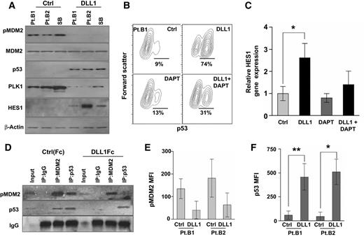 Antileukemia Effects of Notch-Mediated Inhibition of Oncogenic PLK1 in ...