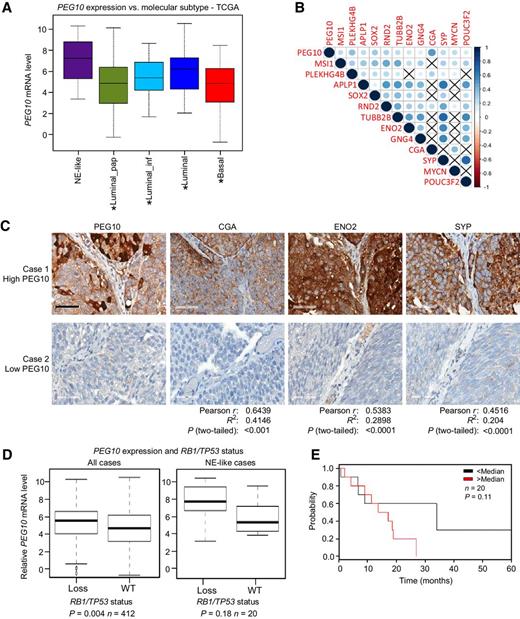 Paternally Expressed Gene 10 (PEG10) Promotes Growth, Invasion, and ...