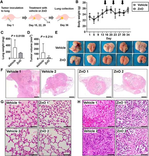 Anticancer Activity of ZnO Nanoparticles against Human Small-Cell Lung Cancer in an Orthotopic ...