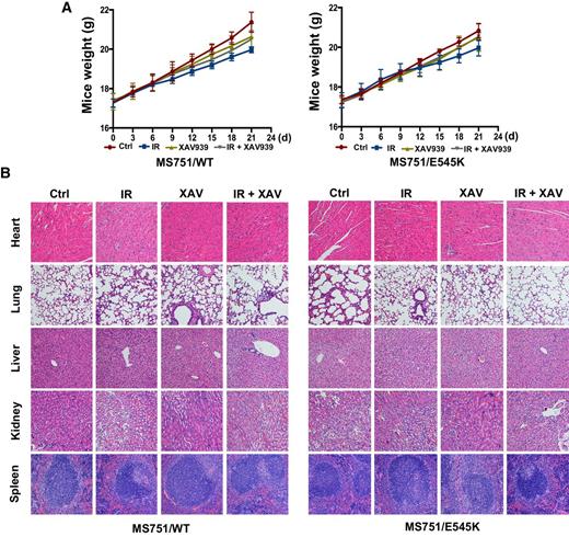 Targeting of β-Catenin Reverses Radioresistance of Cervical Cancer with ...