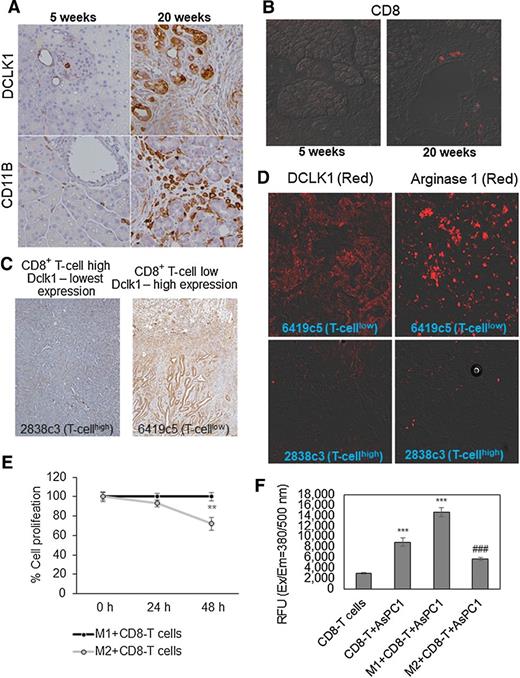 DCLK1-Isoform2 Alternative Splice Variant Promotes Pancreatic Tumor ...