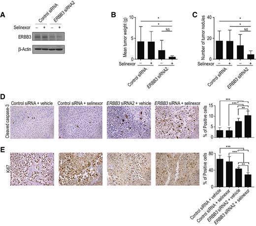 NRG1/ERBB3 Pathway Activation Induces Acquired Resistance to XPO1 ...