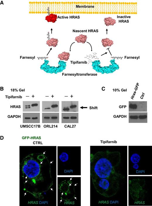 Tipifarnib as a Precision Therapy for HRAS-Mutant Head and Neck ...