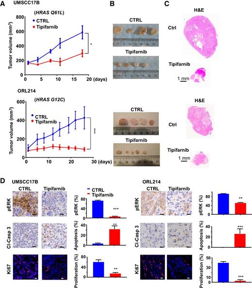 Tipifarnib as a Precision Therapy for HRAS-Mutant Head and Neck ...