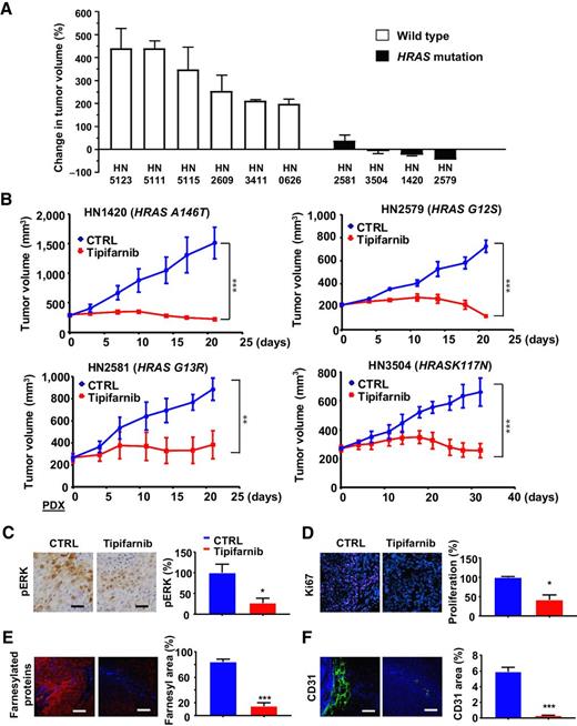 Tipifarnib as a Precision Therapy for HRAS-Mutant Head and Neck ...