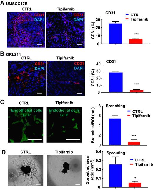 Tipifarnib as a Precision Therapy for HRAS-Mutant Head and Neck ...