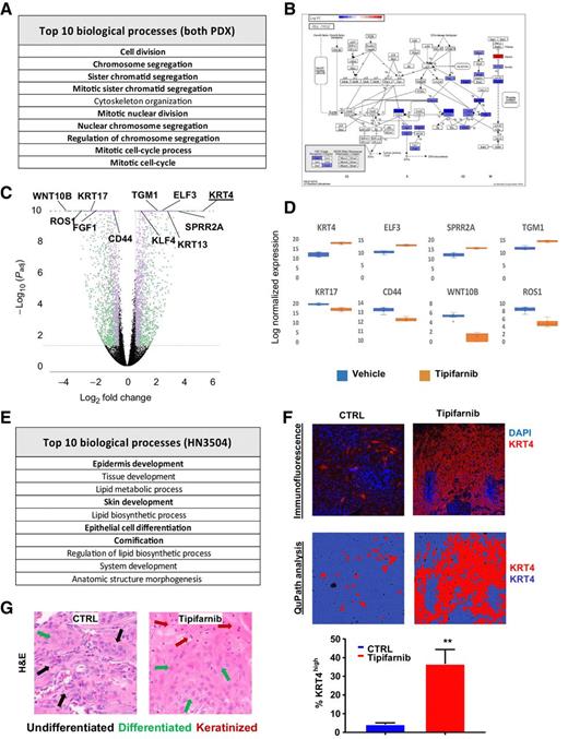 Tipifarnib as a Precision Therapy for HRAS-Mutant Head and Neck ...