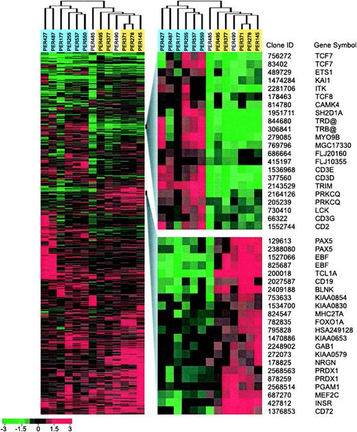 Gene Expression Profiles in a Panel of Childhood Leukemia Cell Lines ...