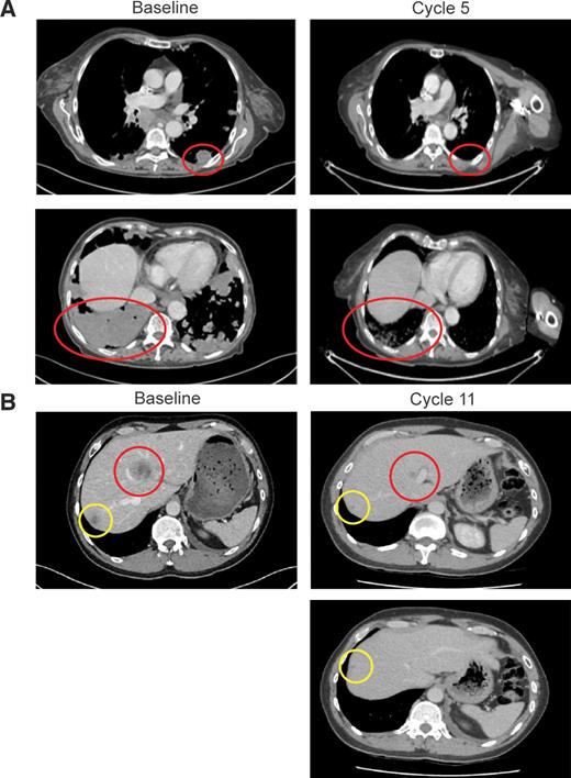 Molecular Characteristics of Repotrectinib That Enable Potent ...