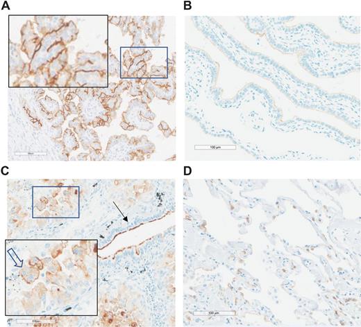 The Dolaflexin-based Antibody–Drug Conjugate XMT-1536 Targets the Solid ...