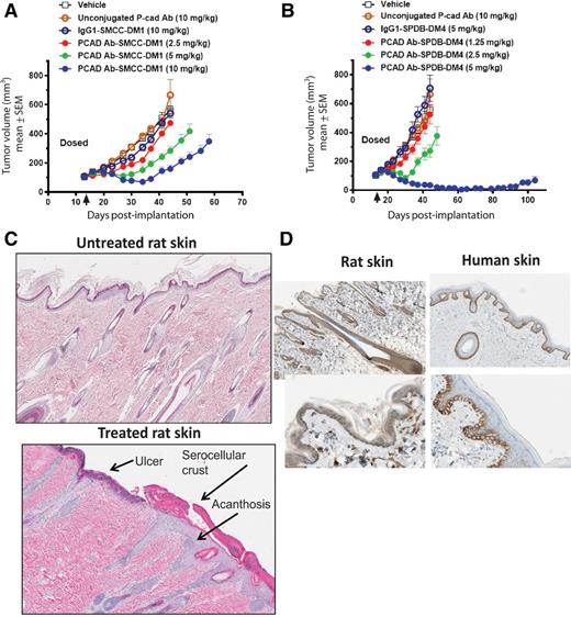 PCA062, a P-cadherin Targeting Antibody–Drug Conjugate, Displays Potent ...