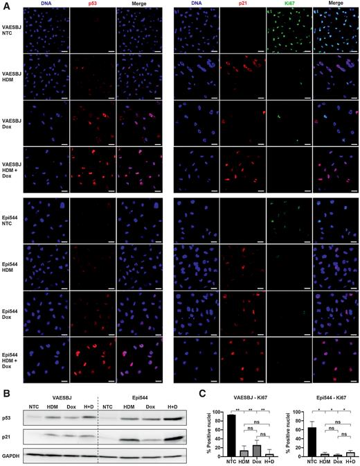 p53 Pathway Inactivation Drives SMARCB1-deficient p53-wildtype ...