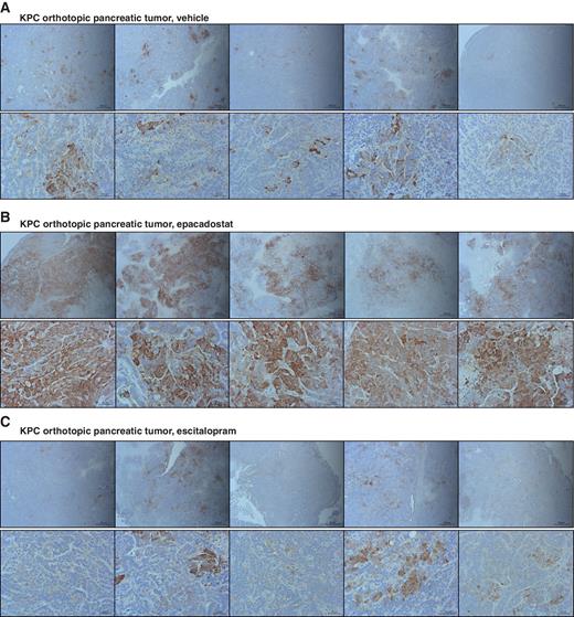 IDO1 Is a Therapeutic Target for Pancreatic Cancer–Associated ...