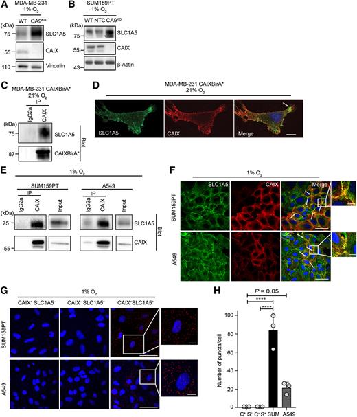 A Carbonic Anhydrase IX/SLC1A5 Axis Regulates Glutamine Metabolism ...