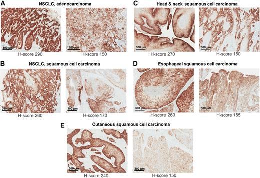 SGN-B6A: A New Vedotin Antibody–Drug Conjugate Directed to Integrin ...