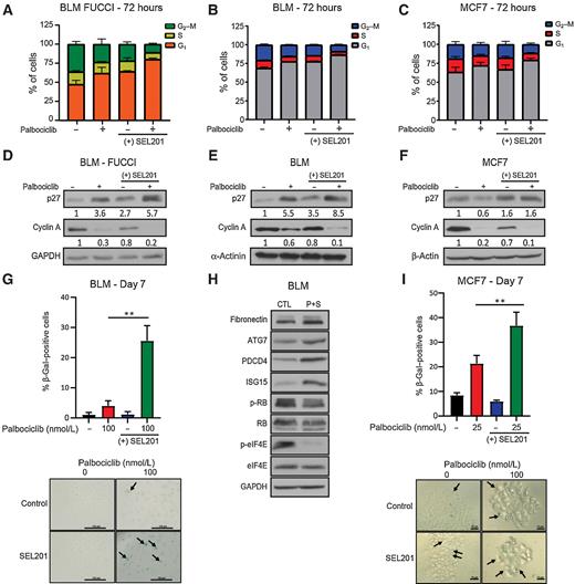 Inhibition of the MNK1/2–eIF4E Axis Augments Palbociclib-Mediated ...
