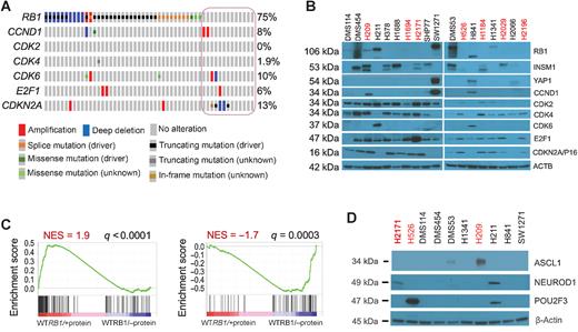 Retinoblastoma Expression and Targeting by CDK4/6 Inhibitors in Small ...