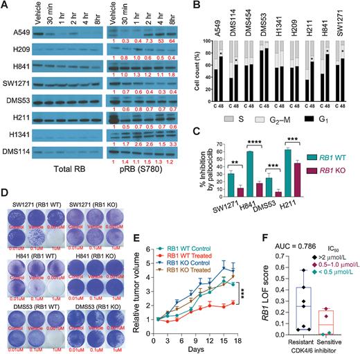 Retinoblastoma Expression and Targeting by CDK4/6 Inhibitors in Small ...