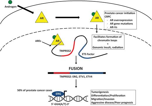 Emerging Developments in ETS-Positive Prostate Cancer Therapy ...