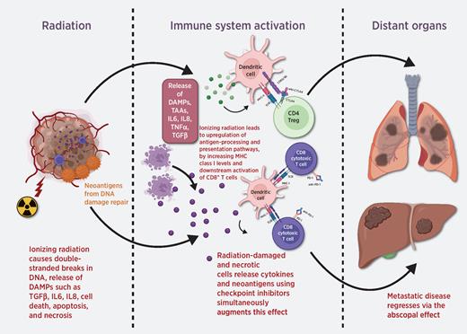 Predicting the Abscopal Effect: Associated Tumor Histologic Subtypes ...