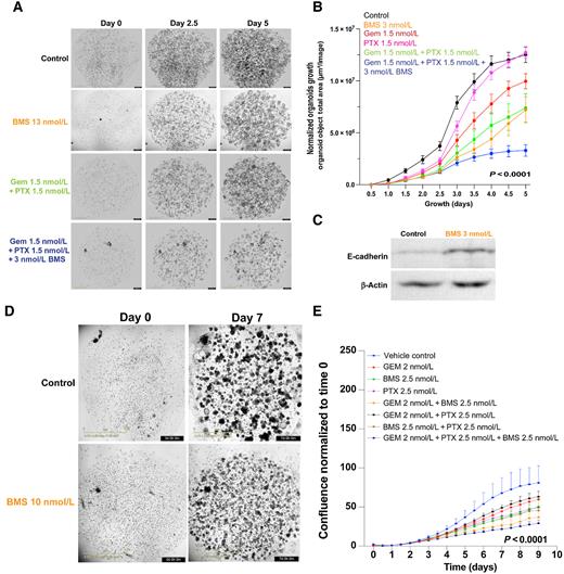 Bromo- and Extra-Terminal Domain Inhibitors Induce Mitochondrial Stress ...
