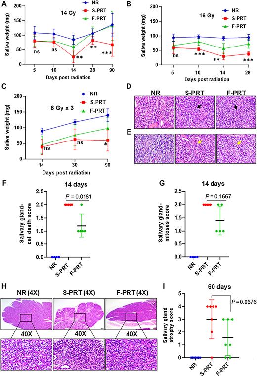 Proton FLASH Radiotherapy Ameliorates Radiation-induced Salivary Gland ...