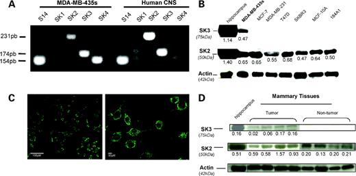 Identification of SK3 channel as a new mediator of breast cancer cell ...
