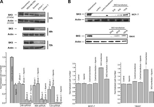 Identification of SK3 channel as a new mediator of breast cancer cell ...
