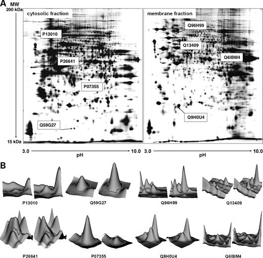 Antitumor activity of CTFB, a novel anticancer agent, is associated ...