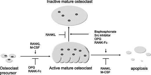 Novel therapeutic strategy for osteosarcoma targeting osteoclast ...