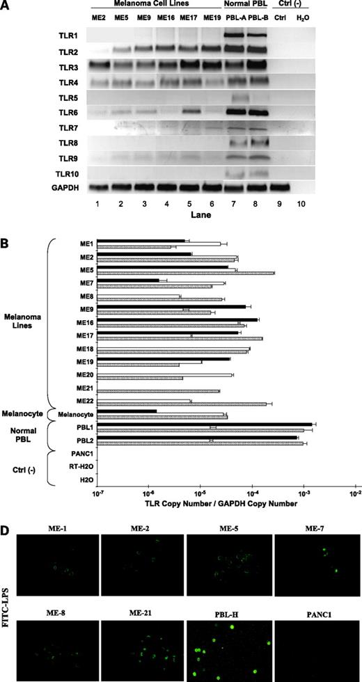 Activation of toll-like receptors 2, 3, and 4 on human melanoma cells ...