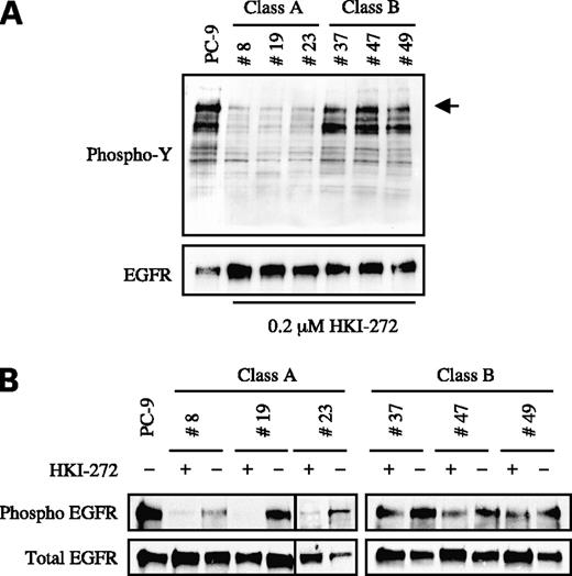 The T790M “gatekeeper” mutation in EGFR mediates resistance to low ...