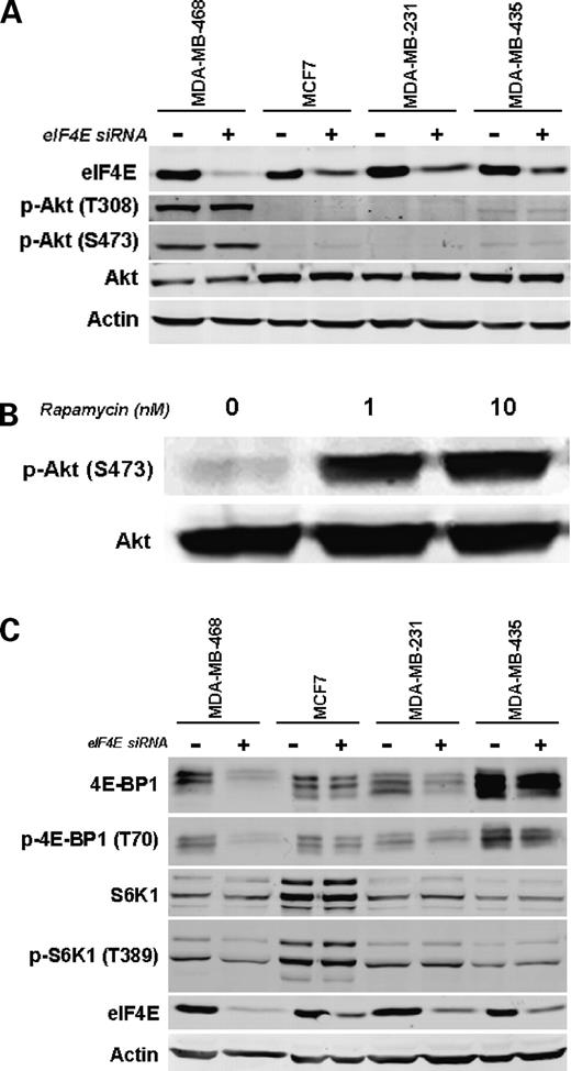 eIF4E knockdown decreases breast cancer cell growth without activating ...