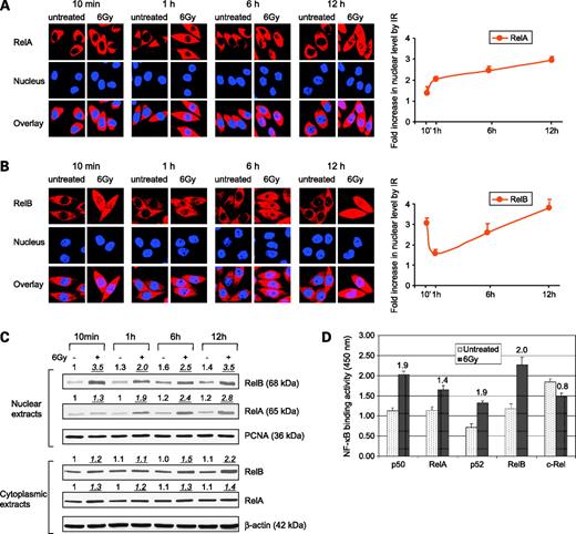 SN52, a novel nuclear factor-κB inhibitor, blocks nuclear import of ...