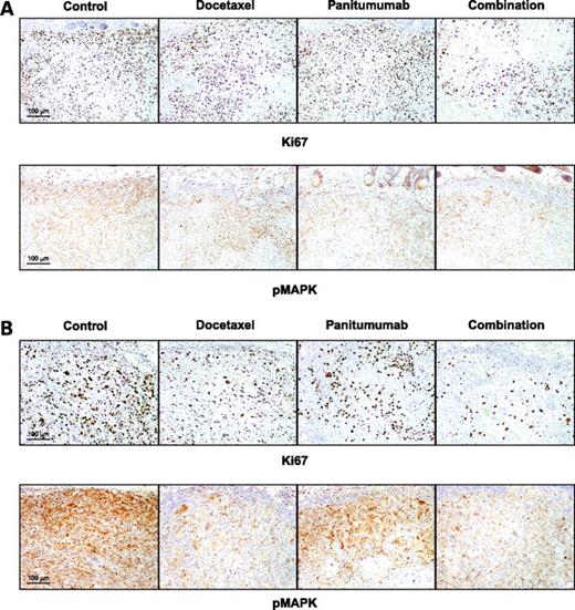 Activity of panitumumab alone or with chemotherapy in non-small cell ...
