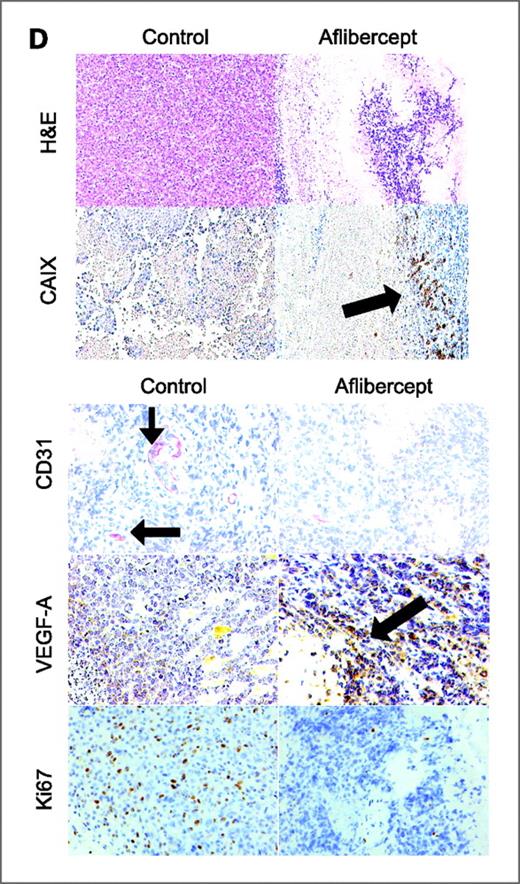 Aflibercept Exerts Antivascular Effects and Enhances Levels of ...