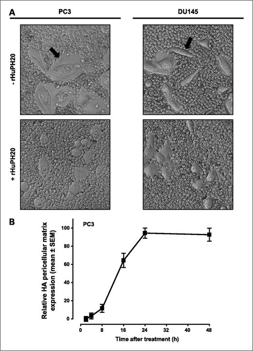 Enzymatic Depletion of Tumor Hyaluronan Induces Antitumor Responses in ...