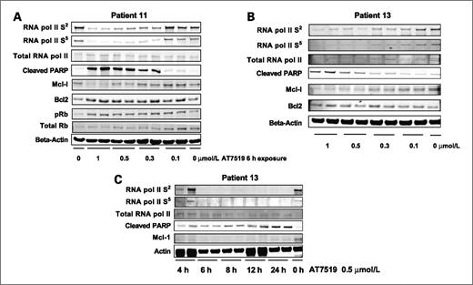 AT7519, a Cyclin-Dependent Kinase Inhibitor, Exerts Its Effects by ...